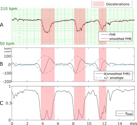 Illustration Of The Computation Of The Prior Probability Signal A An