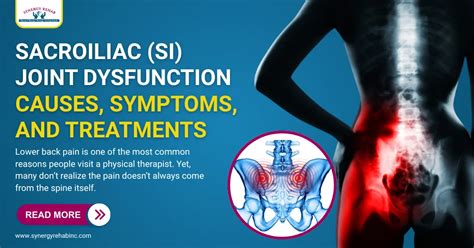 Sacroiliac Joint Dysfunction Causes Symptoms And Treatments