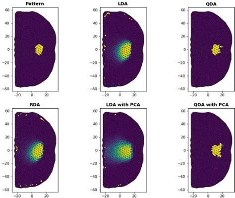 Electrical Impedance Tomography Bladder Monitoring Wearable Device