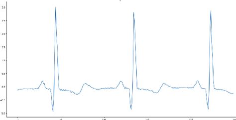 Figure 3 From Sleep Apnea Detection System Using Machine Learning On