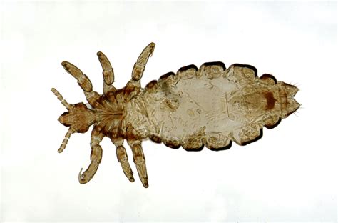 Head Lice Bug