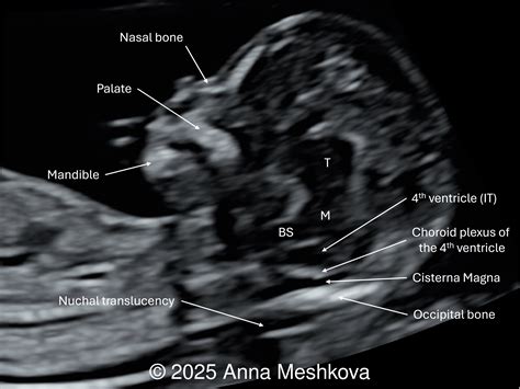 Case Of The Week 625