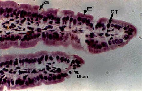 Micrograph Of Duodenum Of Download Scientific Diagram