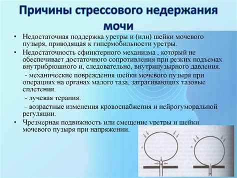 Недержание мочи у женщин презентация онлайн