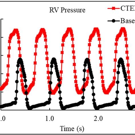 Right Ventricular Pressure Traces From RHC At Baseline And At The Download Scientific Diagram
