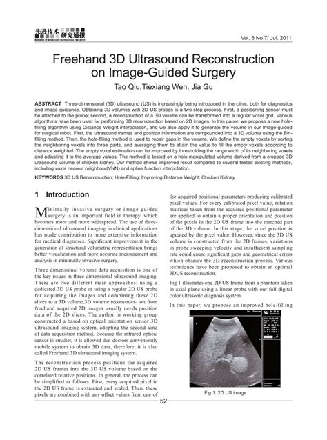 Pdf Freehand 3d Ultrasound Reconstructionon Image Guided Surgery