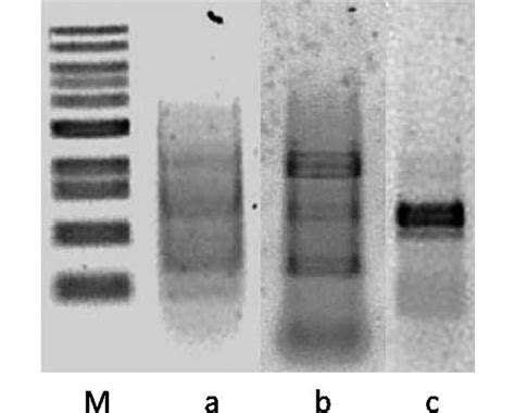 Polyketide Synthase Pks Fragment Amplified With Degenerate Primers