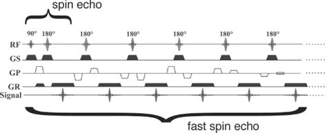 Fast Spin Echo Imaging Radiology Key