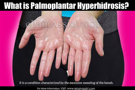 Palmoplantar Hyperhidrosis Causes Symptoms Treatment