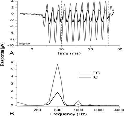 Intracochlear Electrocochleography During Cochlear Implantat Otology And Neurotology