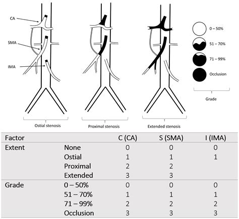 Inferior Mesenteric Artery Model