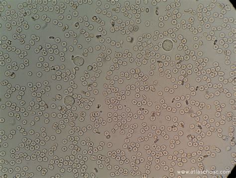 Hemograma Eritrocitos My XXX Hot Girl