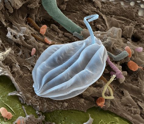 Flagellate Protozoan Sem Stock Image C0574246 Science Photo Library