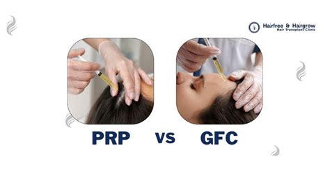 Difference Between PRP And GFC Hair Restoration Treatment Comparison