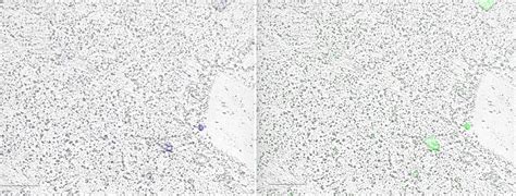 Dapi Staining On Fixed With Formaldehyde Caco 2 Cells Illustrating Cross… Abigail Louise Stocks