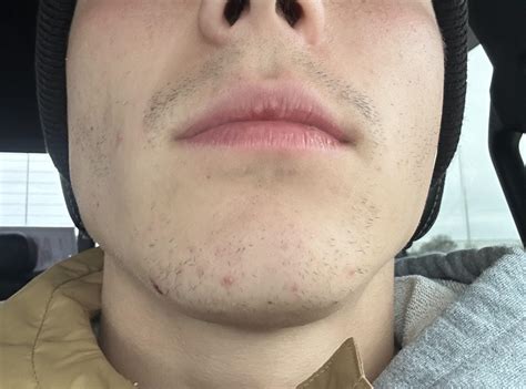 Is This Enough To Grow A Little Goatee Rfacialhair