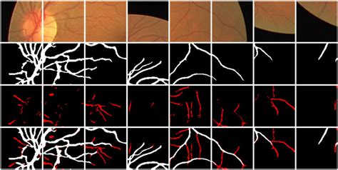 Visual Results Of Patch Based Multi Scale Line Detection Using Download Scientific Diagram