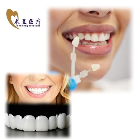 Tooth Veneer High Quality Hecheng Dental