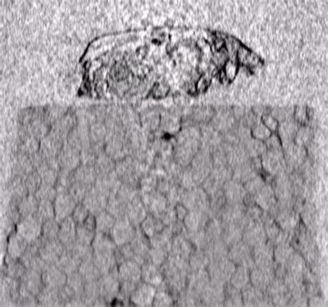 X Ray Phase Contrast Imaging Microsystems Engineering Science And Applications Mesa