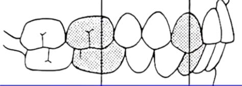 Occlusion Flashcards Quizlet