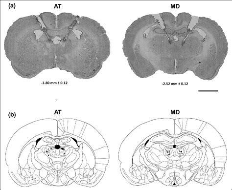 Figure 1 From Dissociable Contributions Of Mediodorsal And Anterior Thalamic Nuclei In Visual