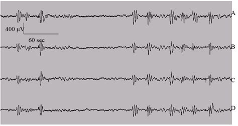 CLINICAL AUTONOMIC NEUROPHYSIOLOGY AND THE MALE SEXUAL RESPONSE AN OVERVIEW PMC