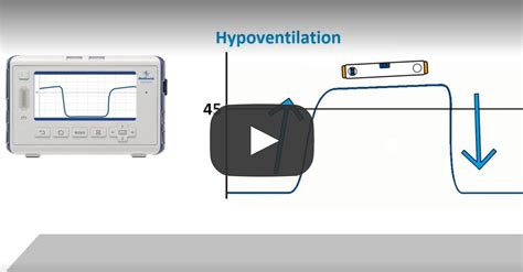 Shayna Jackson On Linkedin Mededbyte Medtronicemployee