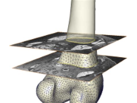 shape informed medical image segmentation zib de