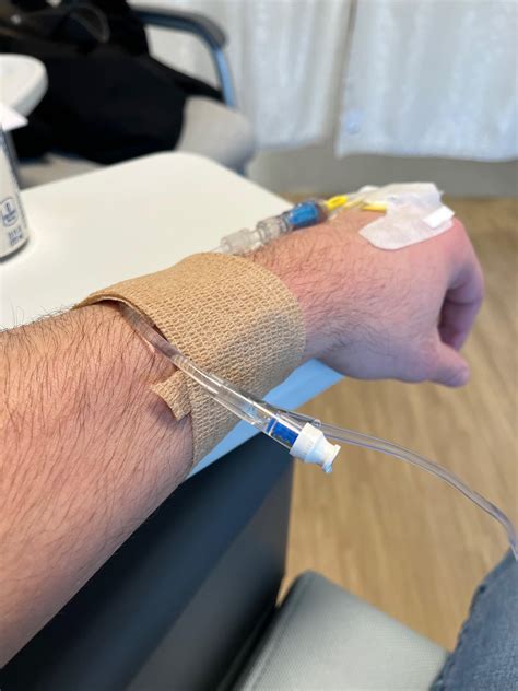 Entyvio First Loading Dose Went Smoothly Rulcerativecolitis