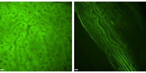 Autofluorescence As An Aid To Discovery Bliq Photonics