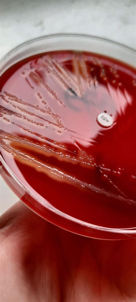 Streptococcus Pyogenes Is An Important Global Human Pathogen That Causes A Wide Variety Of Acute