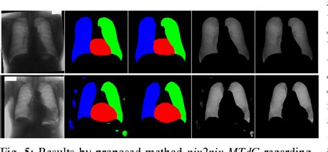 Figure 1 From Image To Images Translation For Multi Task Organ