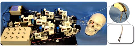Novel Multi Arm Robot Developed For Eye Interventions Kings College London