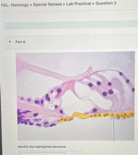 Solved Identify The Highlighted Structure