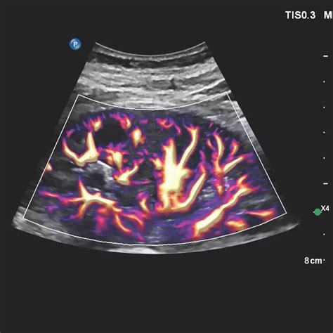 Microflow Imaging Products And Services Philips