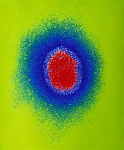 Coloured Tem Of A Single Influenza Virus Photograph By Nibsc False Colour Transmission Electron