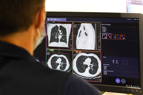 Nhs Urges People To Take Up Lung Cancer Check As 600 Diagnosed In Mobile Trucks The Argus