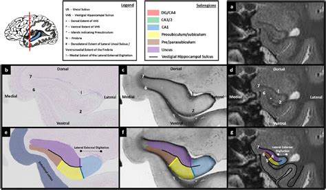 Segmenting Subregions Of The Human Hippocampus On Structural Magnetic