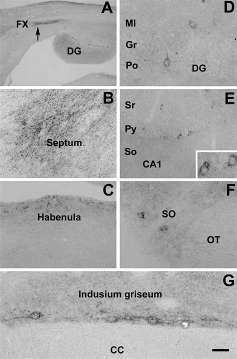 Distribution Of Retrograde Bda Labeling In Sagittal Sections Of The