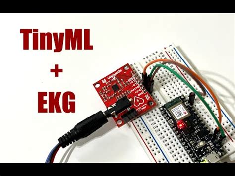 TinyML Tutorial Detecting Arrhythmias With AD And TensorFlow Lite On Arduino Nano BLE