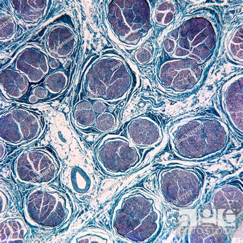 Cross Section Demonstrating The Structure Of A Human Sciatic Nerve