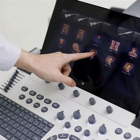 News Sonoscape Europe