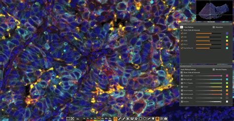 vacuole quantification module archives indica labs