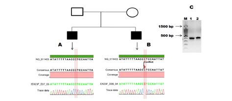 Identiication Of A Novel Frame Shift Mutation In Factor Viii Gene Download Scientific Diagram