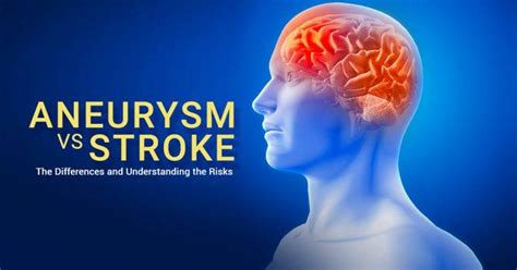 How To Differentiate Aneurysm From Stroke