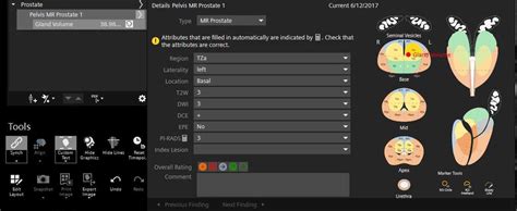 mr prostate ai based segmentation and classification