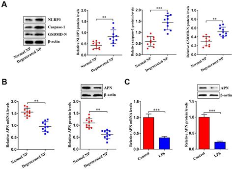 figure 1 from adiponectin inhibits lps induced nucleus pulposus cell