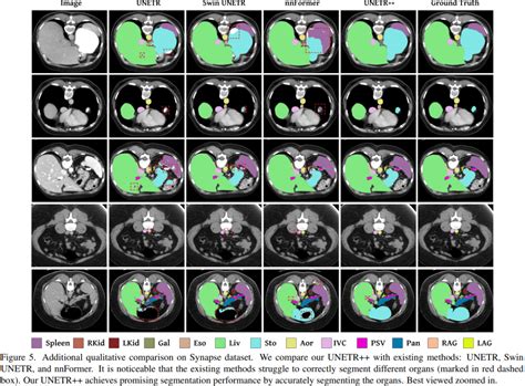 超越nnformer！unetr ：高效准确的3d医学图像分割 unetr delving into efficient and