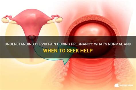 Understanding Cervix Pain During Pregnancy Whats Normal And When To