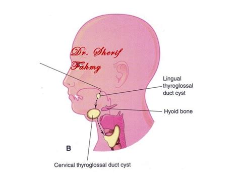 Development Of Thyroid Gland Special Embryology Pps